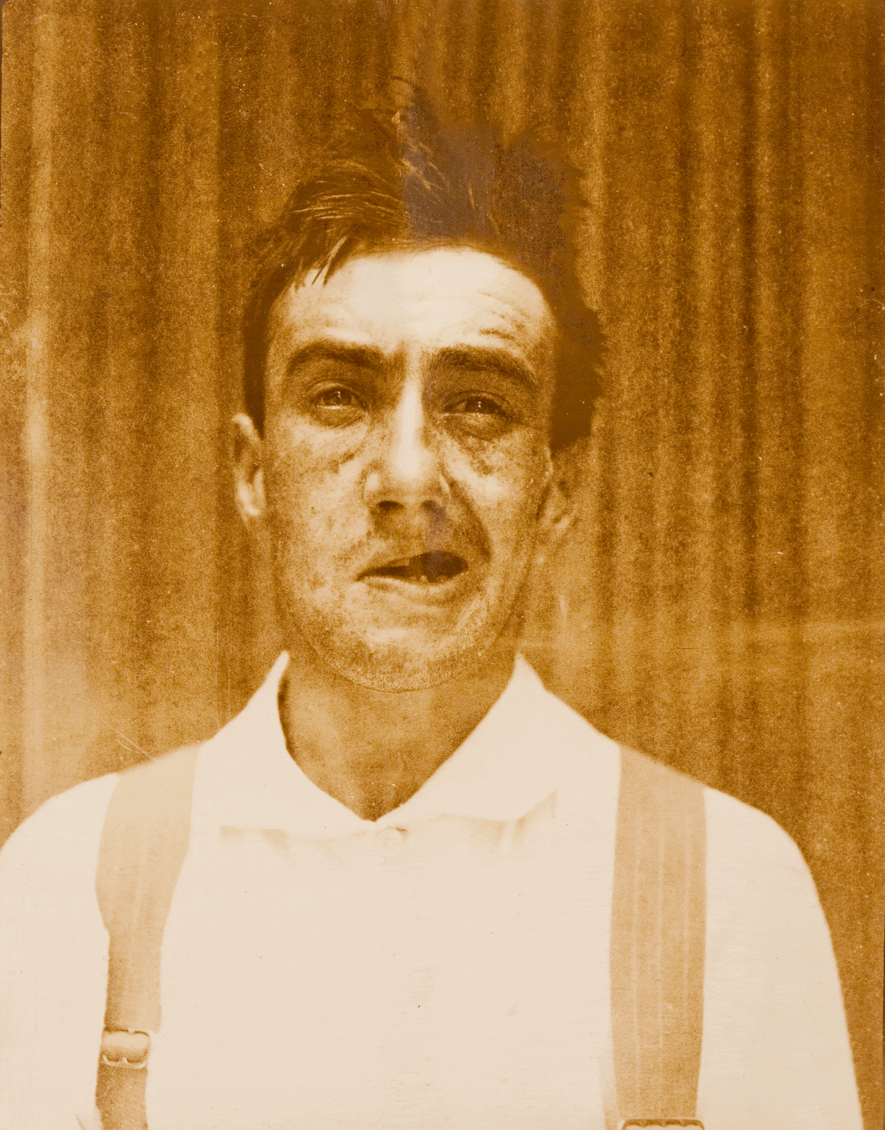 ‘Shell shock’ Revisited: An Examination of the Case Records of the ...