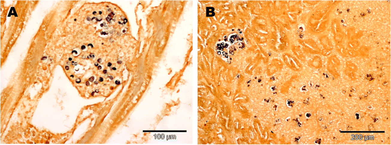 One Perkinsus species may hide another: characterization of Perkinsus ...