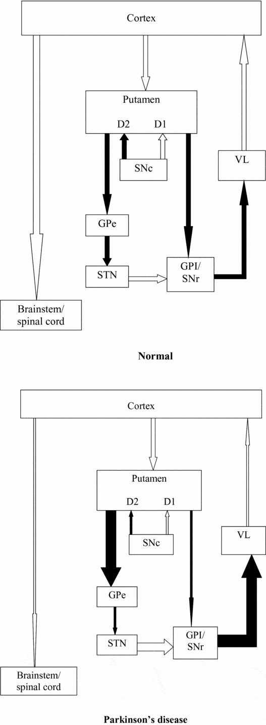 Parkinson's disease – pathology, aetiology and diagnosis | Reviews in ...