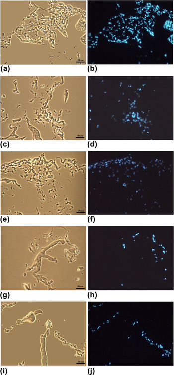 Biocomposites based on collagen and phosphorylated dextran for bone ...
