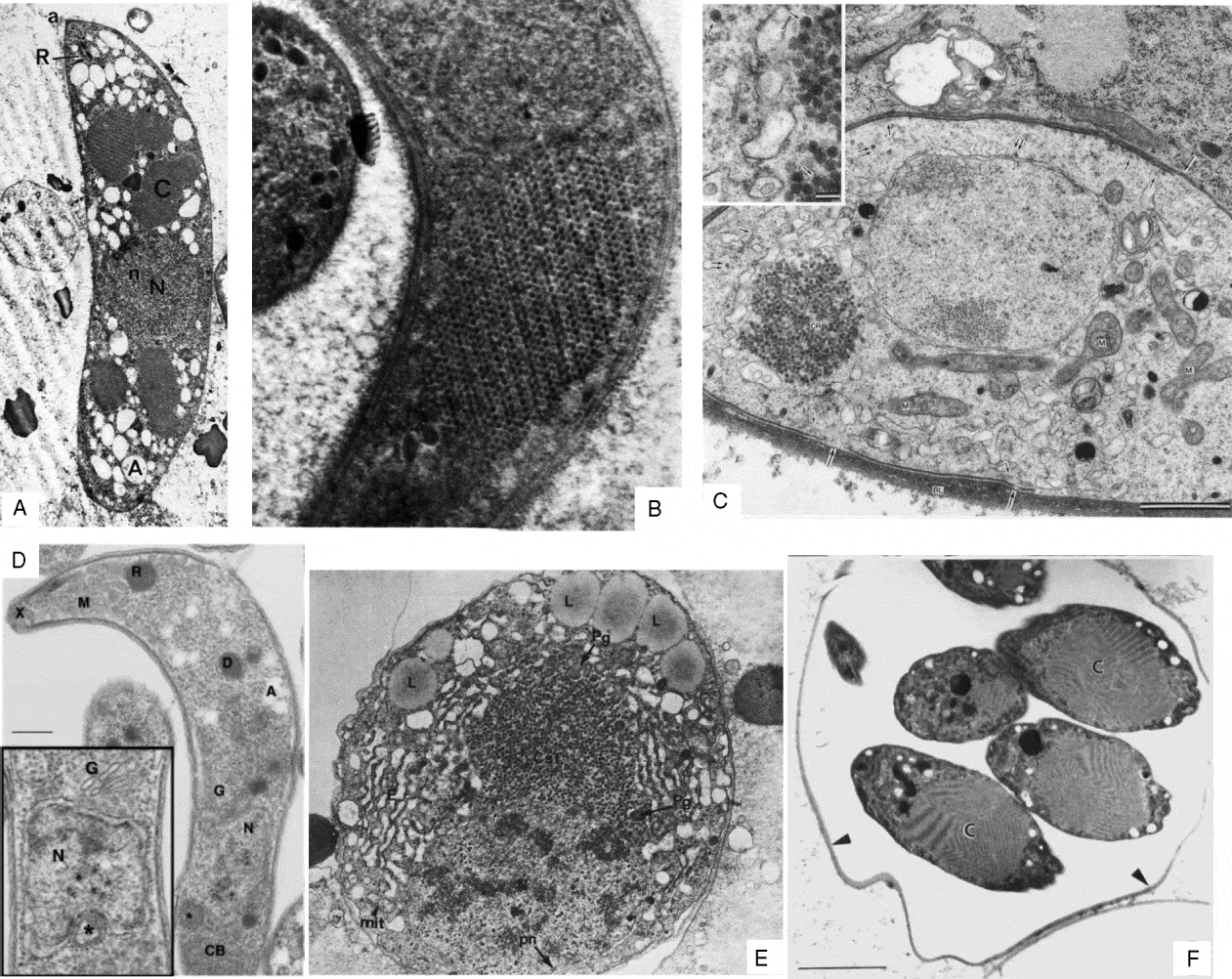 Crystalloid body, refractile body and virus-like particles in ...