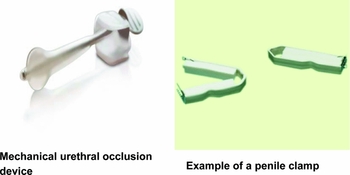 Continence aids in the management of urinary incontinence | Reviews in ...