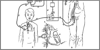 12th Annual C. Walton Lillehei Memorial Lecture in Cardiovascular ...
