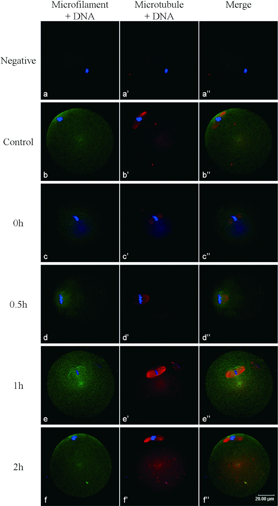 Cytochalasin B treatment of mouse oocytes during intracytoplasmic sperm ...