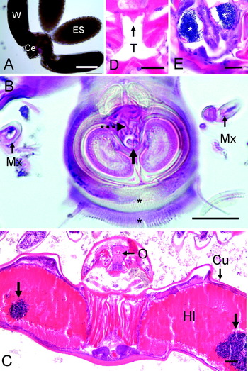 Morphology and pathology of the ectoparasitic copepod, Nicothoë astaci ...