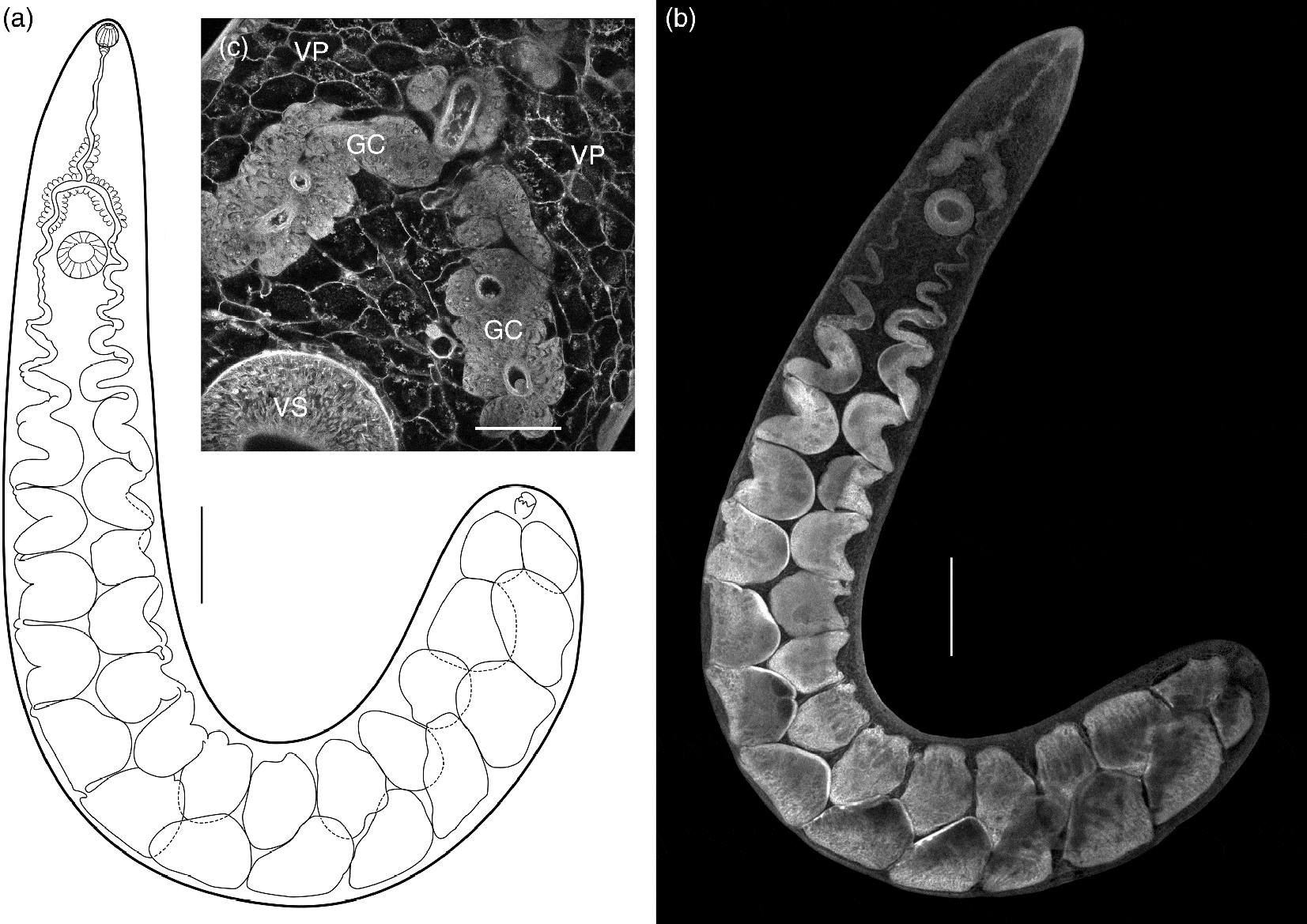 Juvenile didymozoids of the types, Torticaecum and Neotorticaecum ...