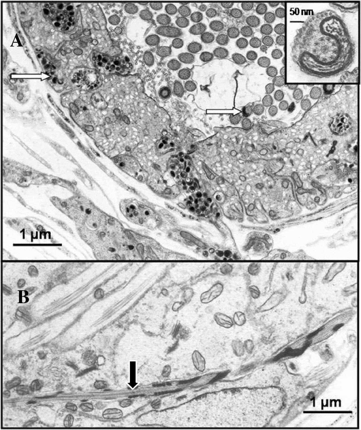 Taenia crassiceps: in vivo and in vitro models | Parasitology ...