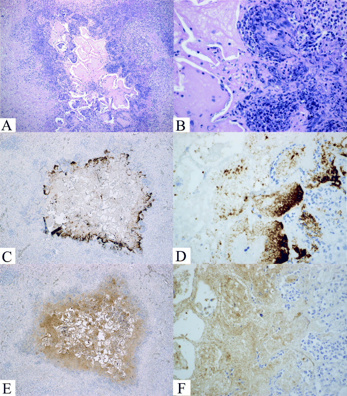 Mycoplasma bovis pneumonia in cattle | Animal Health Research Reviews ...