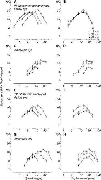 Sensitivity to visual motion in amblyopic macaque monkeys | Visual ...