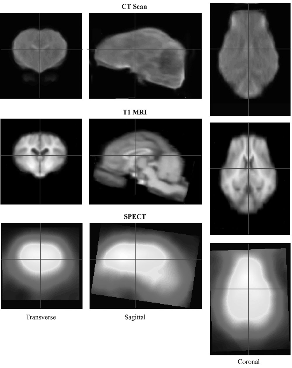 The pig model in brain imaging and neurosurgery | animal | Cambridge Core