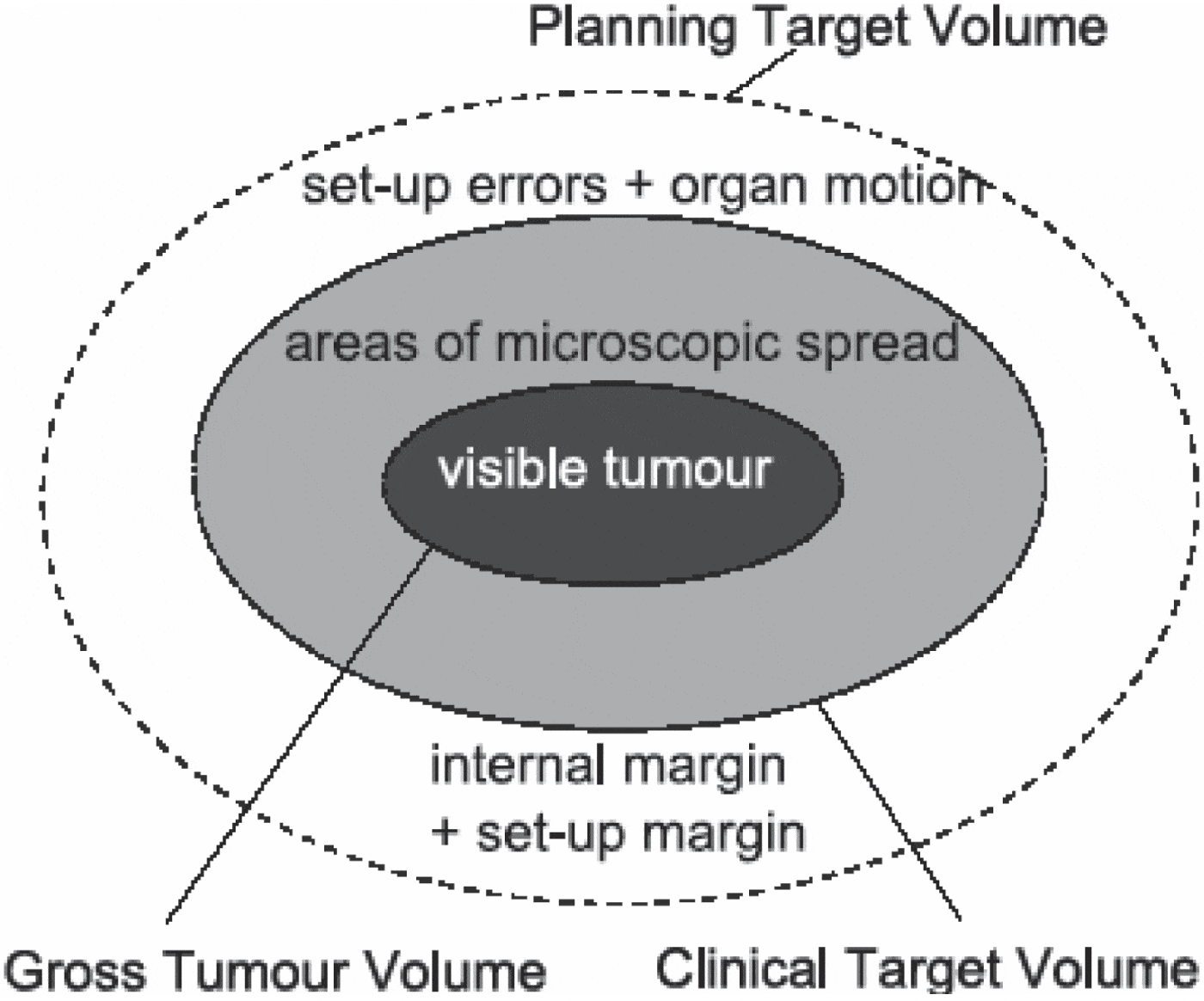Determination of target volumes in radiotherapy and the implications of ...