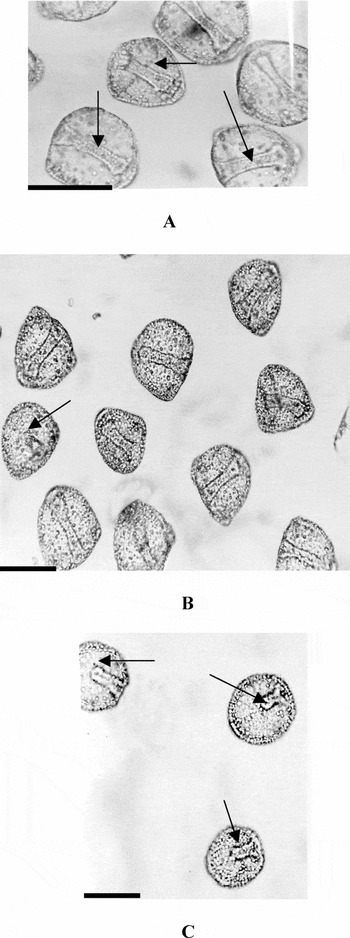 Exogenous hyalin and sea urchin gastrulation. Part III: Biological ...
