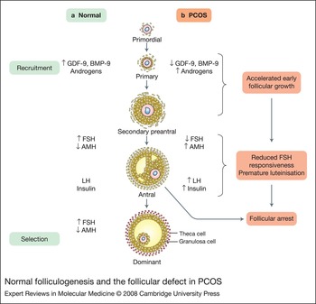 Polycystic ovarian syndrome: pathophysiology, molecular aspects and ...