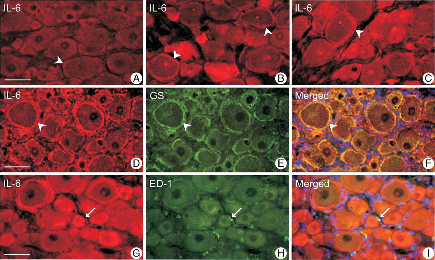 Satellite glial cells express IL-6 and corresponding signal-transducing ...
