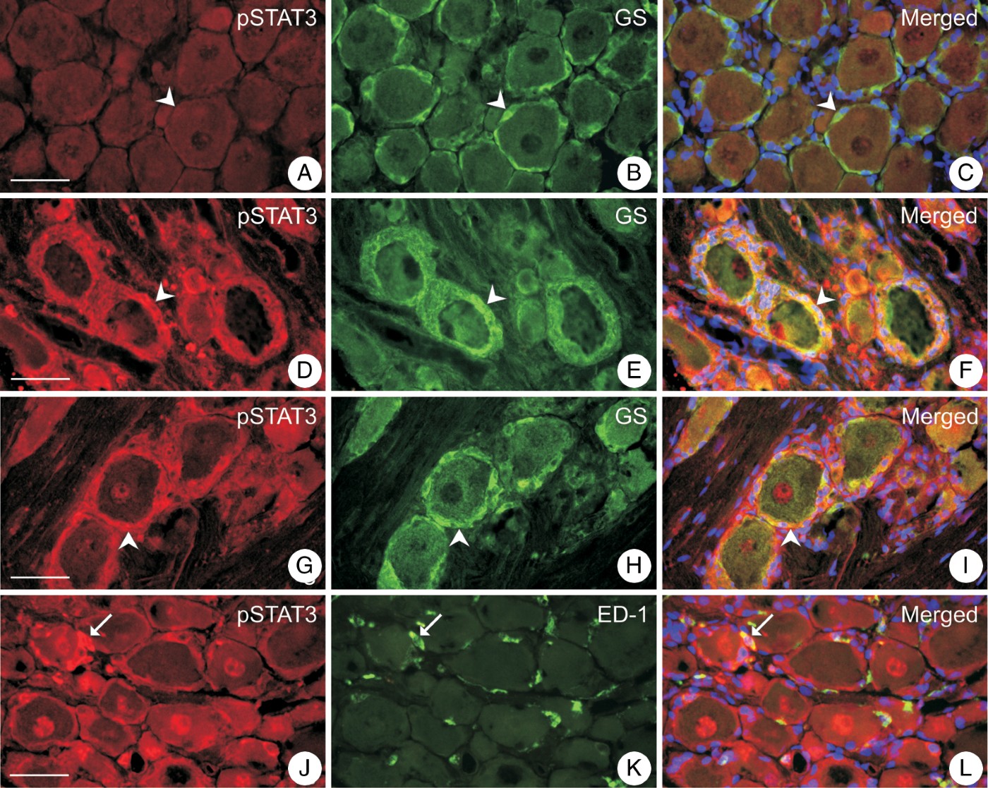 Satellite glial cells express IL-6 and corresponding signal-transducing ...