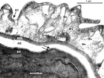 Ultrastructure of the egg shell of the acanthocephalan ...