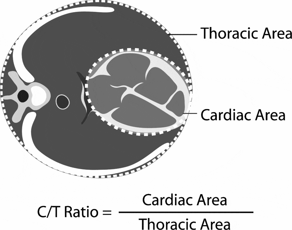 FETAL BRADYCARDIA. A PRACTICAL APPROACH | Fetal and Maternal Medicine ...