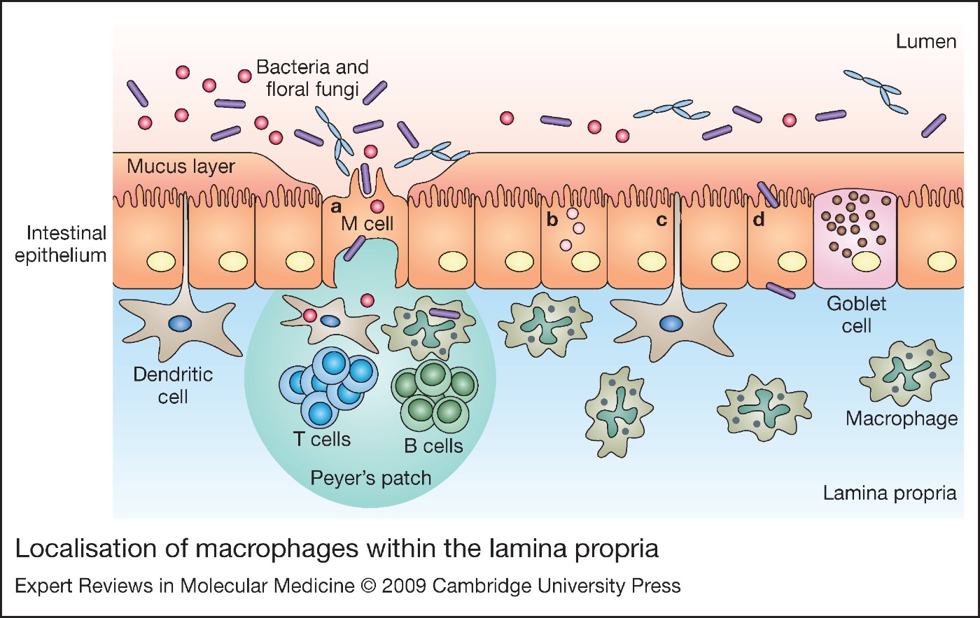 The role of macrophages in inflammatory bowel diseases | Expert Reviews ...