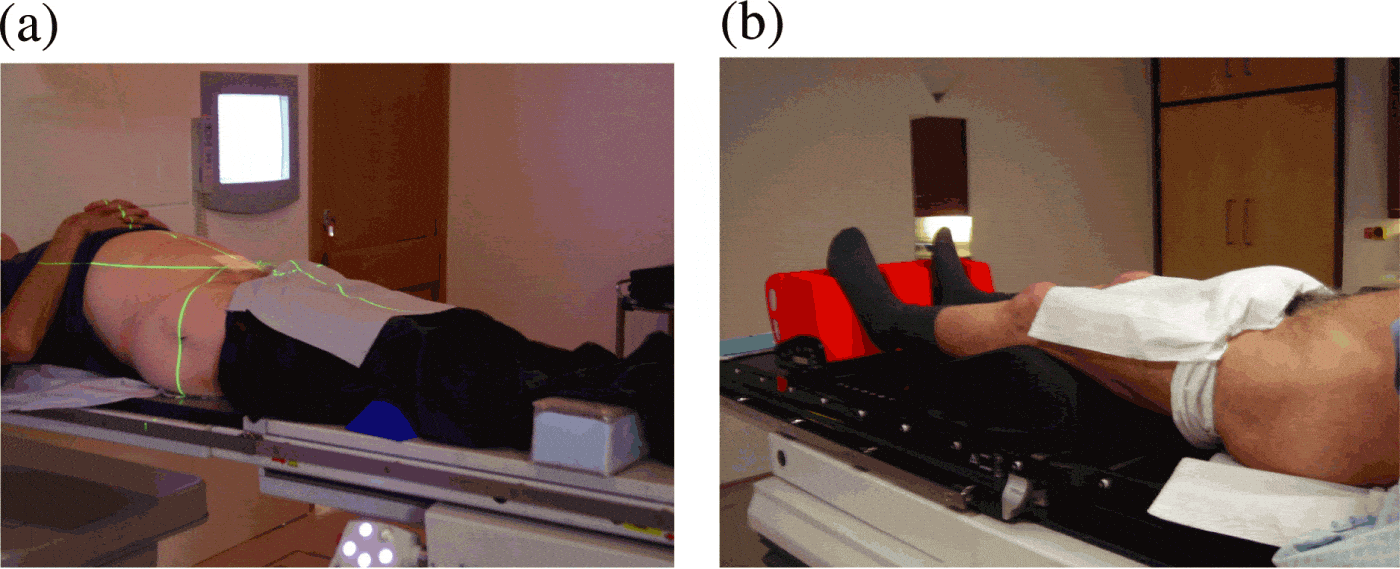 Set-up accuracy of an external immobilisation system for patients ...