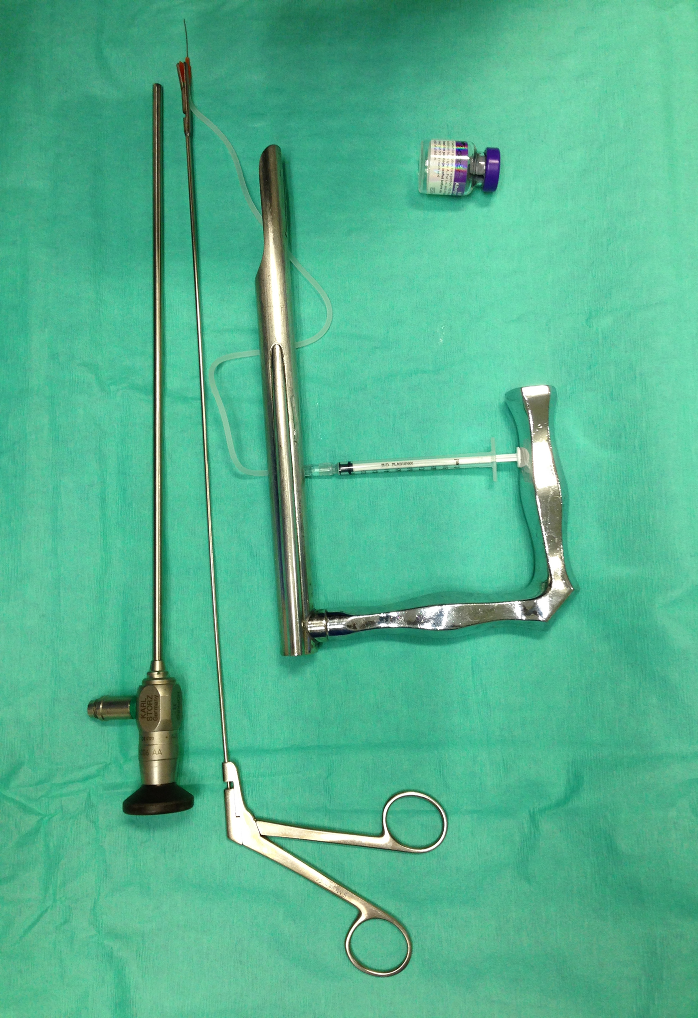 Endoscopic-guided injection of botulinum toxin into the cricopharyngeus ...