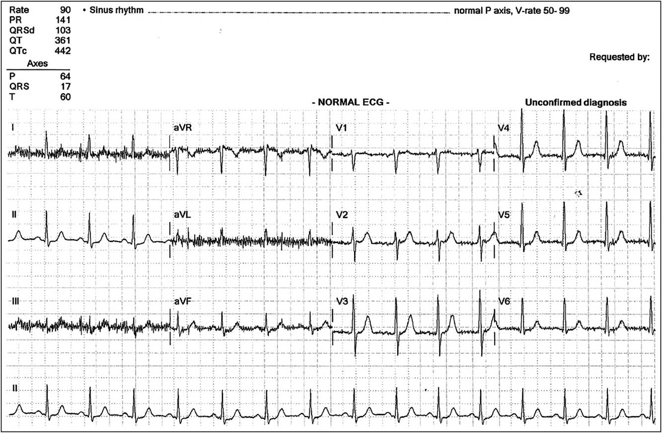 Prehospital Synchronized Electrical Cardioversion of a Poorly Perfused ...