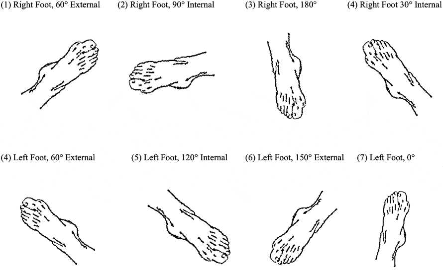 Mental motor imagery and chronic pain: The foot laterality task ...