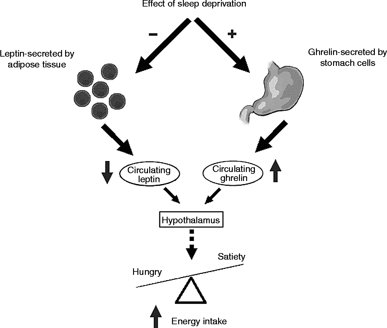 The influence of sleep and sleep loss upon food intake and metabolism ...