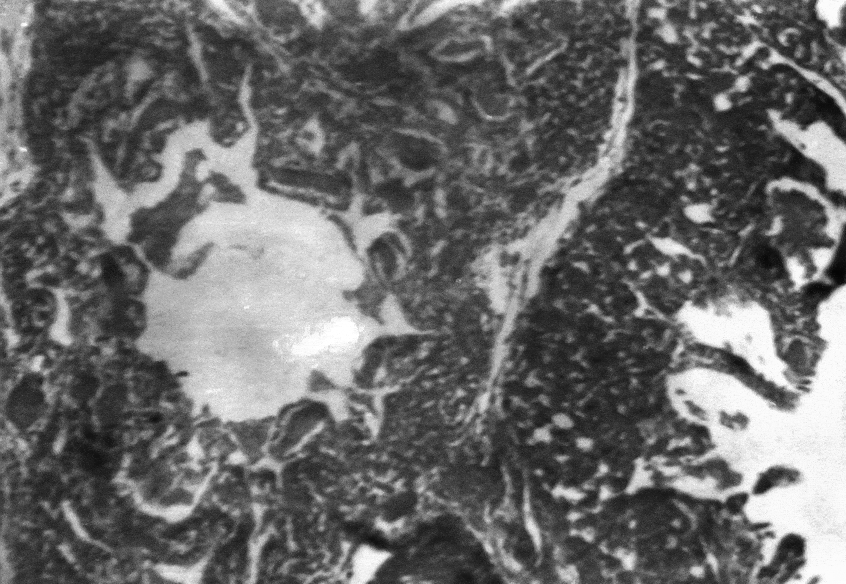 Ascites syndrome in poultry: a review | World's Poultry Science Journal ...