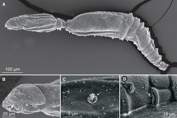 A new species of Paraseison (Rotifera: Seisonacea) from the coast of ...