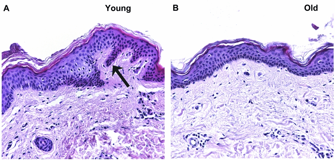 Delayed wound healing in elderly people | Reviews in Clinical ...