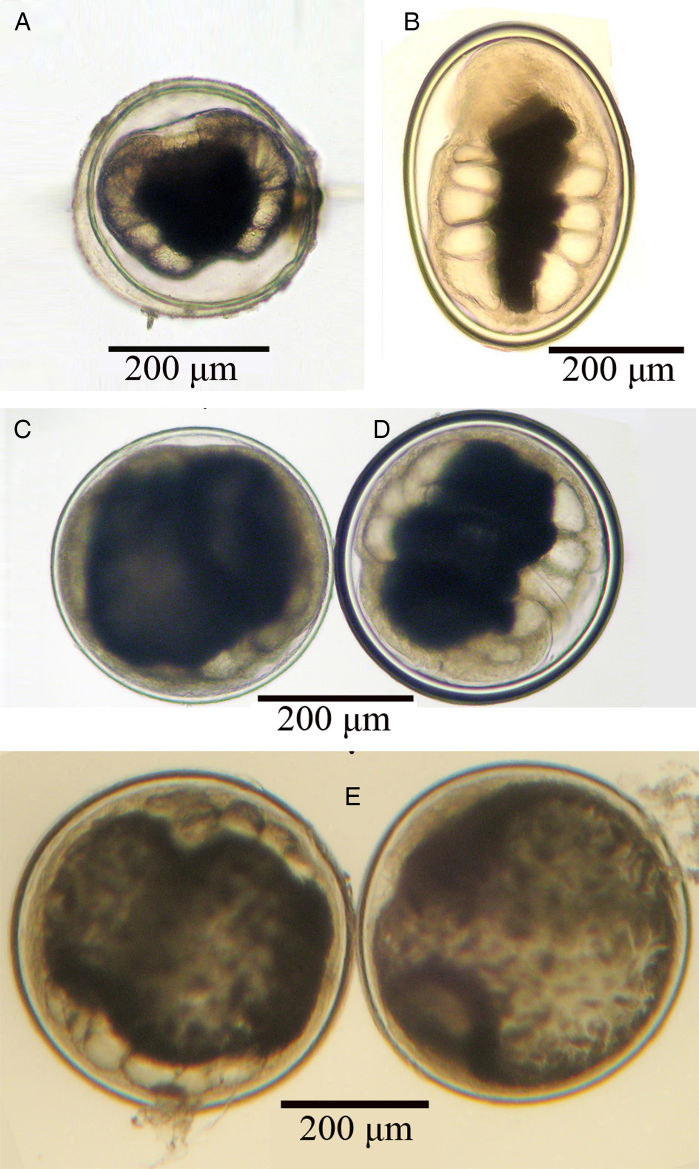 Molecular and morphological variation of Paragonimus westermani in ...
