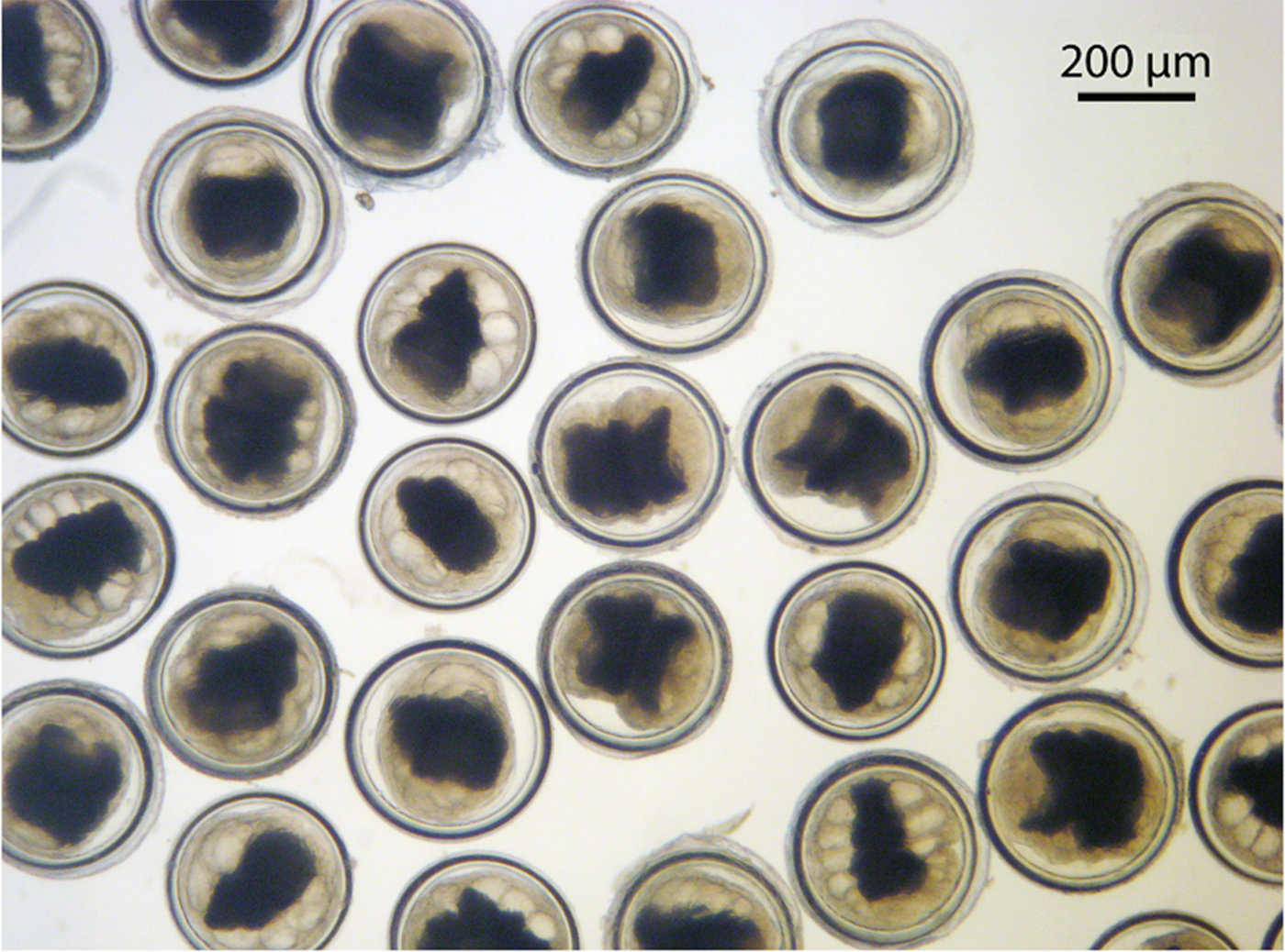 Molecular and morphological variation of Paragonimus westermani in ...