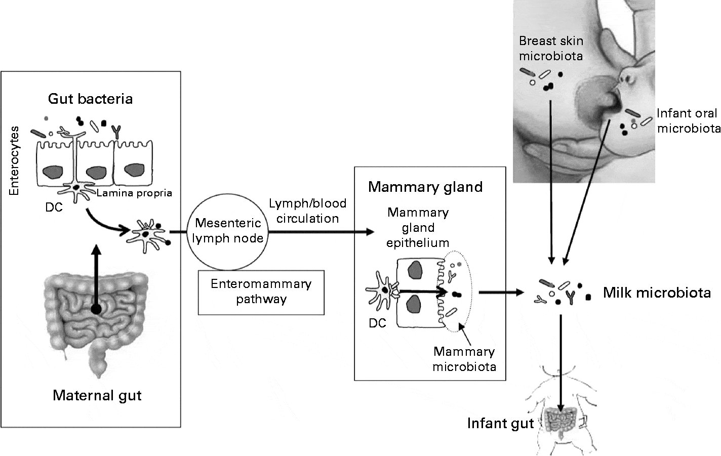 Probiotics in human milk and probiotic supplementation in infant ...