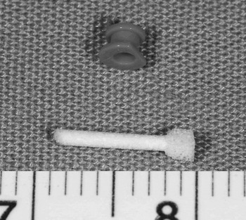 Transtympanic gentamicin treatment using Silverstein MicroWick in ...