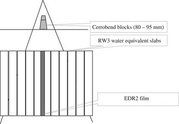 Radiation dose distribution under the area protected using a Cerrobend ...