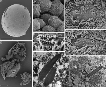 Ultrastructure observation on the cells at different life history ...