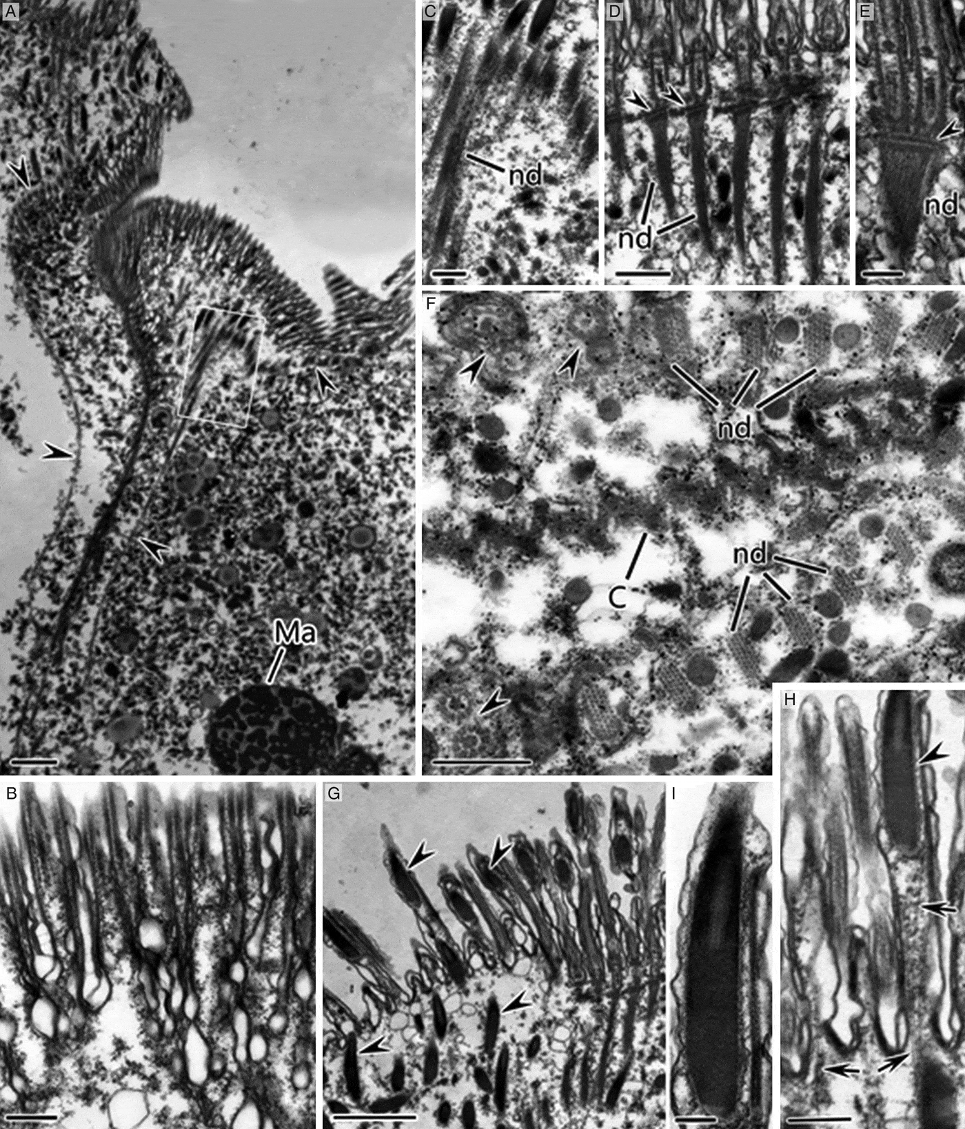 Ultrastructure observation on the cells at different life history ...