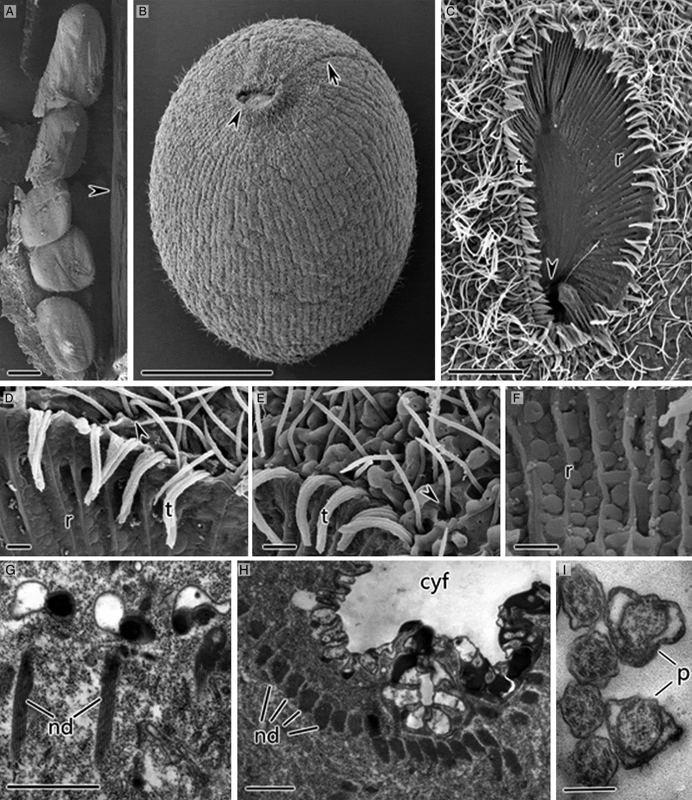 Ultrastructure observation on the cells at different life history ...