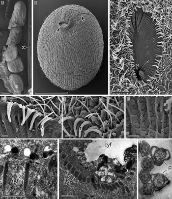 Ultrastructure observation on the cells at different life history ...