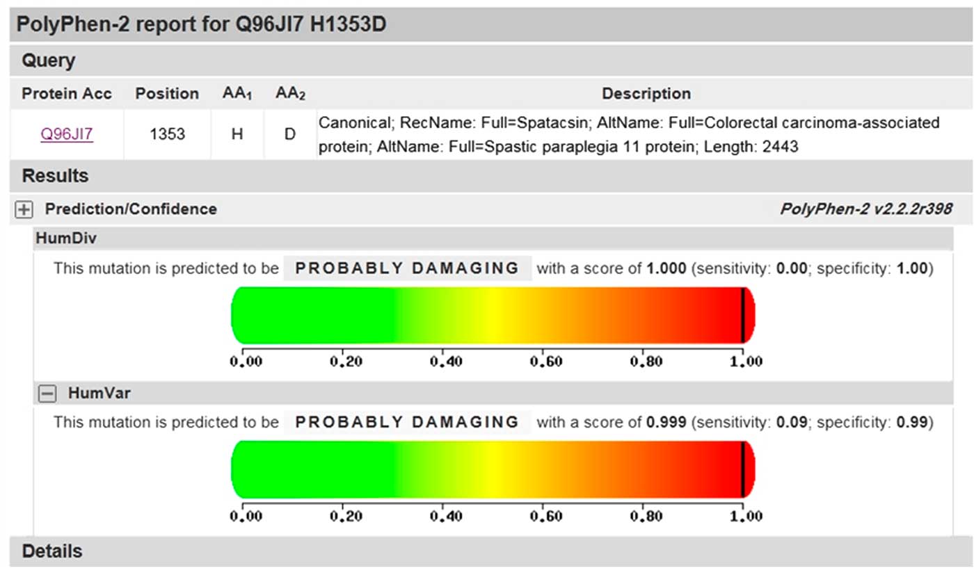 Novel SPG 11 Mutations in Hereditary Spastic Paraplegia With Thin ...