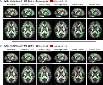 Processing speed impairment in schizophrenia is mediated by white ...
