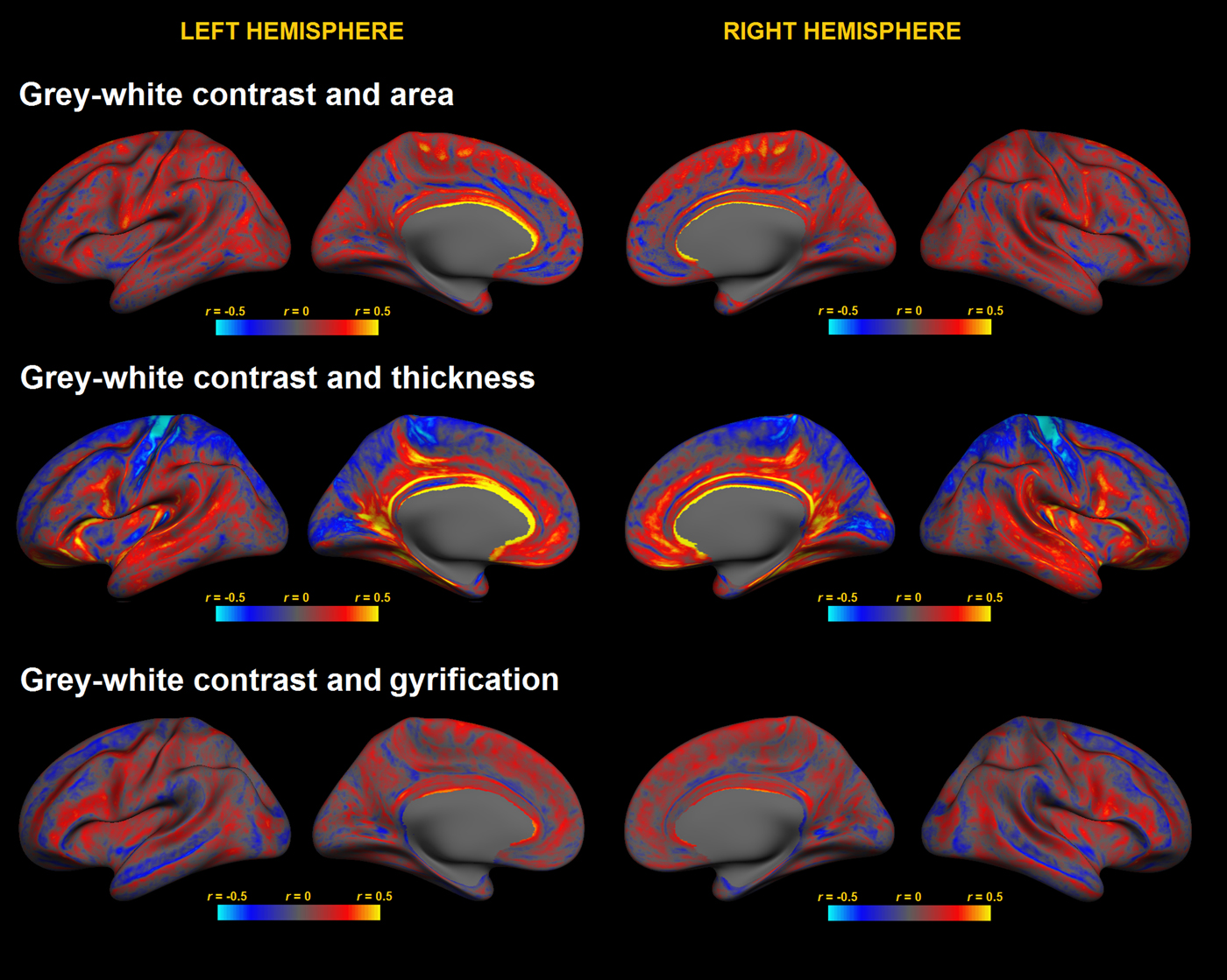 Increased MRI-based cortical grey/white-matter contrast in sensory and ...