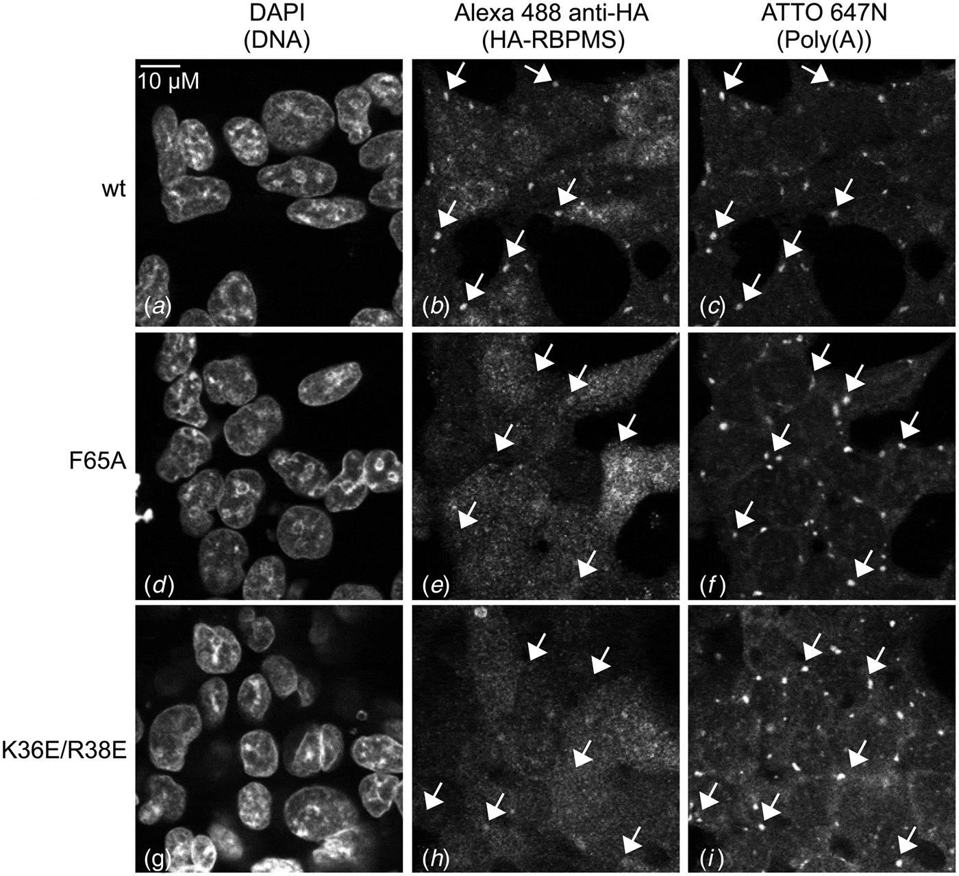 Structural basis underlying CAC RNA recognition by the RRM domain of ...