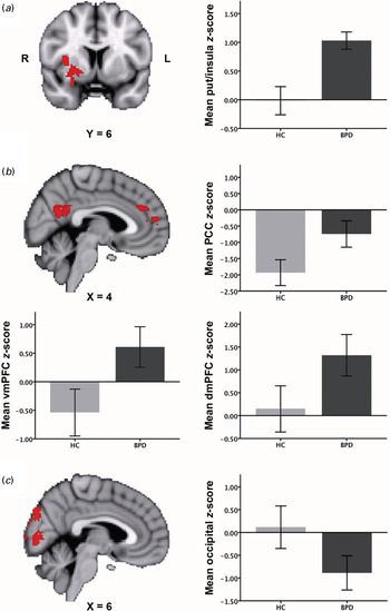 Amygdala and anterior cingulate resting-state functional connectivity ...
