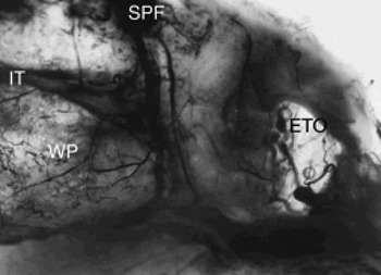 Woodruff's plexus | The Journal of Laryngology & Otology | Cambridge Core