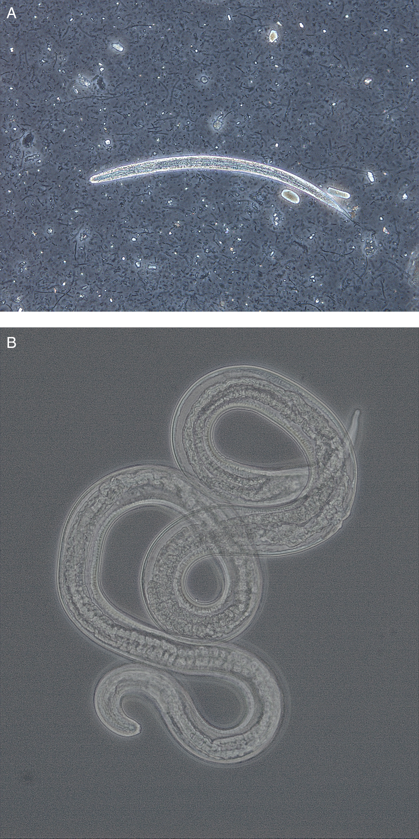 Strongyloides spp. infections of veterinary importance | Parasitology ...