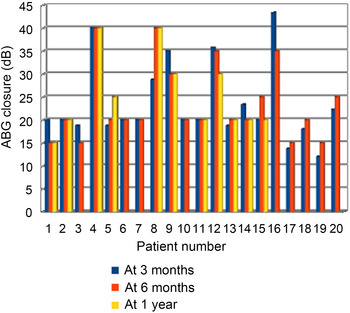 Autologous incus versus titanium partial ossicular replacement ...