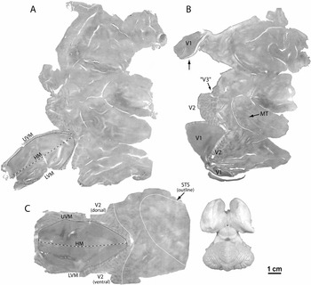 Complete flatmounting of the macaque cerebral cortex | Visual ...