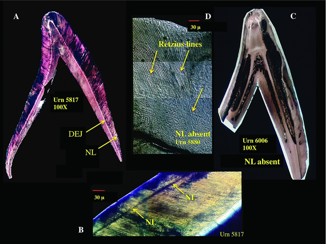 Two tales of one city: data, inference and Carthaginian infant sacrifice | Antiquity | Cambridge ...