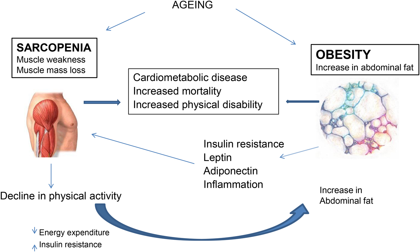 Muscle loss and obesity: the health implications of sarcopenia and ...